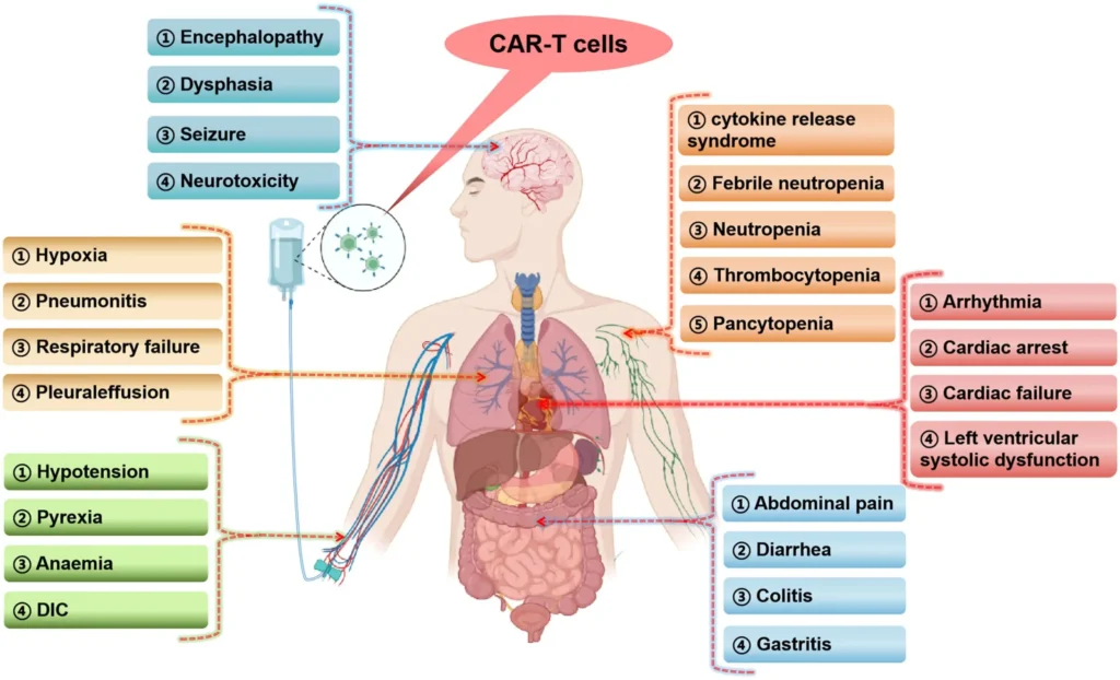 Comprehensive Guide to CAR-T Cell Therapy in Cancer Treatment